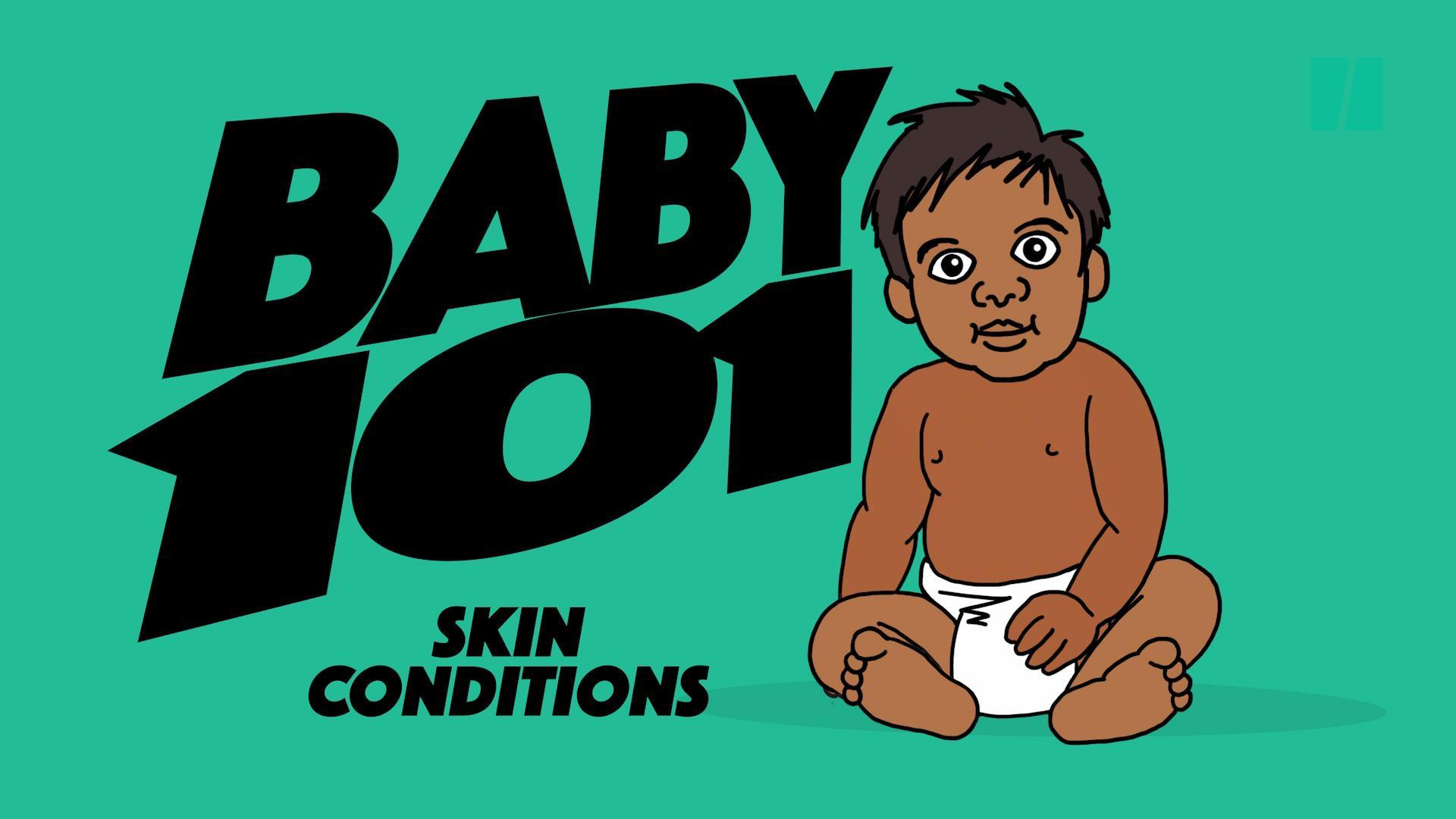 Does Your Baby Have A Rash? How To Know When You Should Take Them To A ...