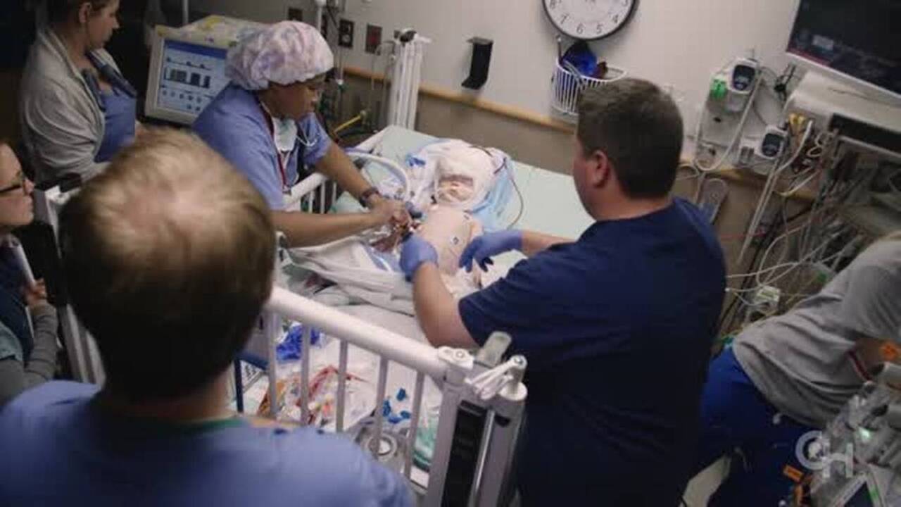NC Conjoined Twins Abby and Erin Delaney- A Year in the Life ...