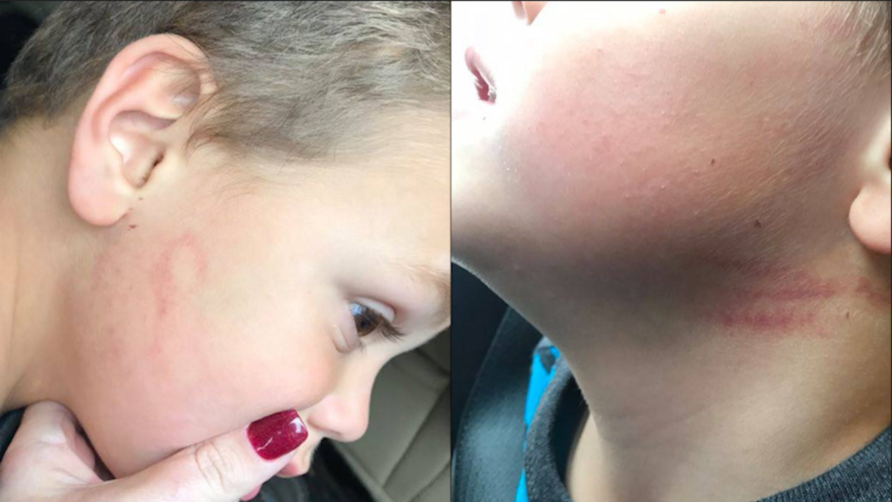 Video shows daycare teacher holding down a 4-year-old and slapping him ...