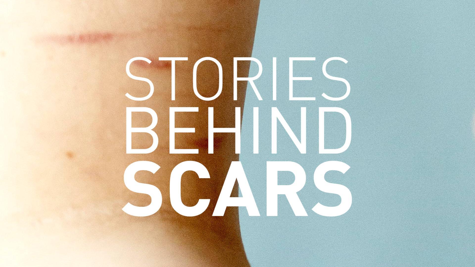 'Behind The Scars': The Poignant Photo Project Showing All Skin Is ...