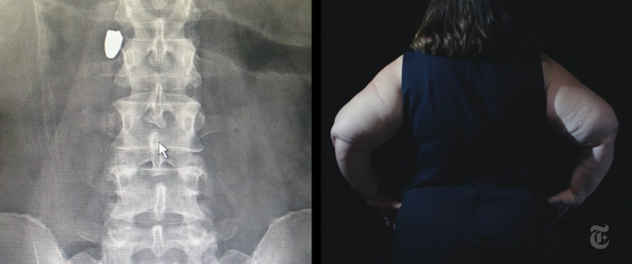 The bullet inside my body | The State