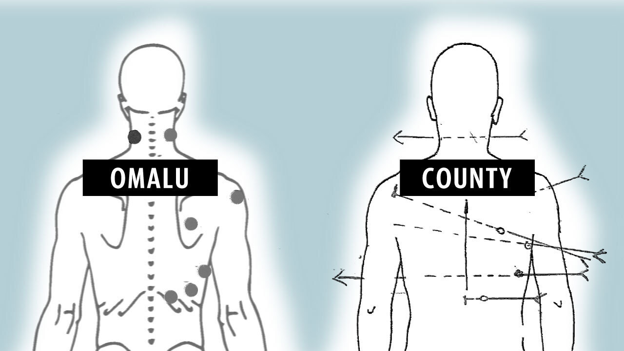 See how the two autopsy reports in the Stephon Clark shooting case ...