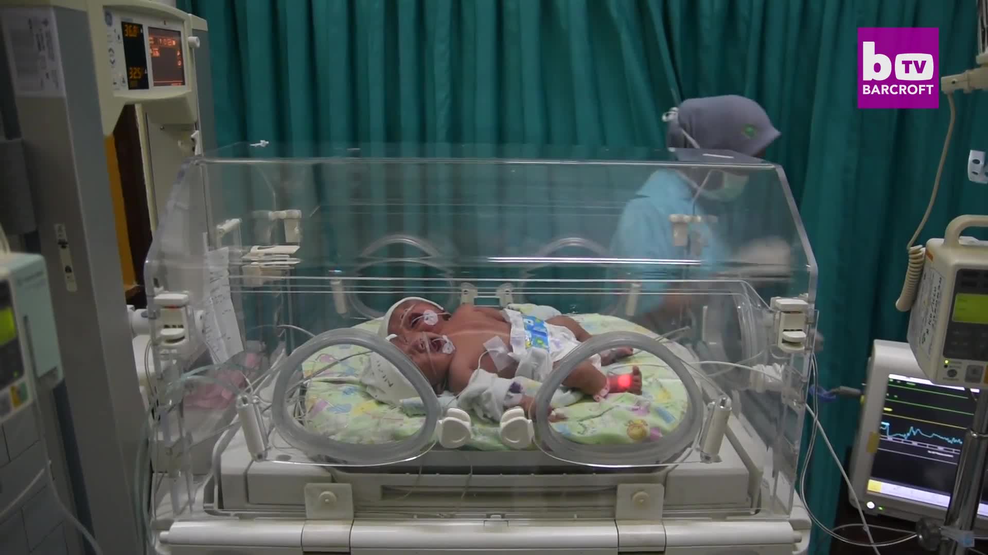 Two-Headed Baby Reportedly Born In Indonesia | HuffPost UK Parents