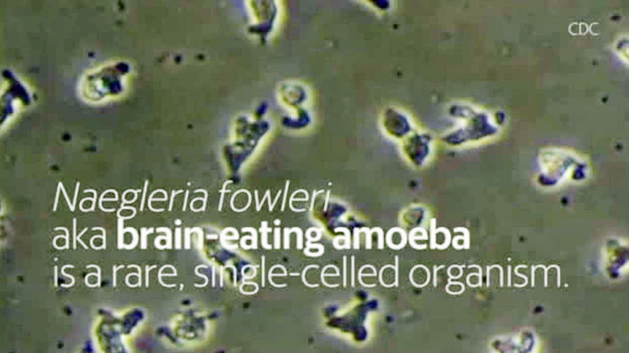 Brain-eating amoeba: What you need to know | Raleigh News & Observer