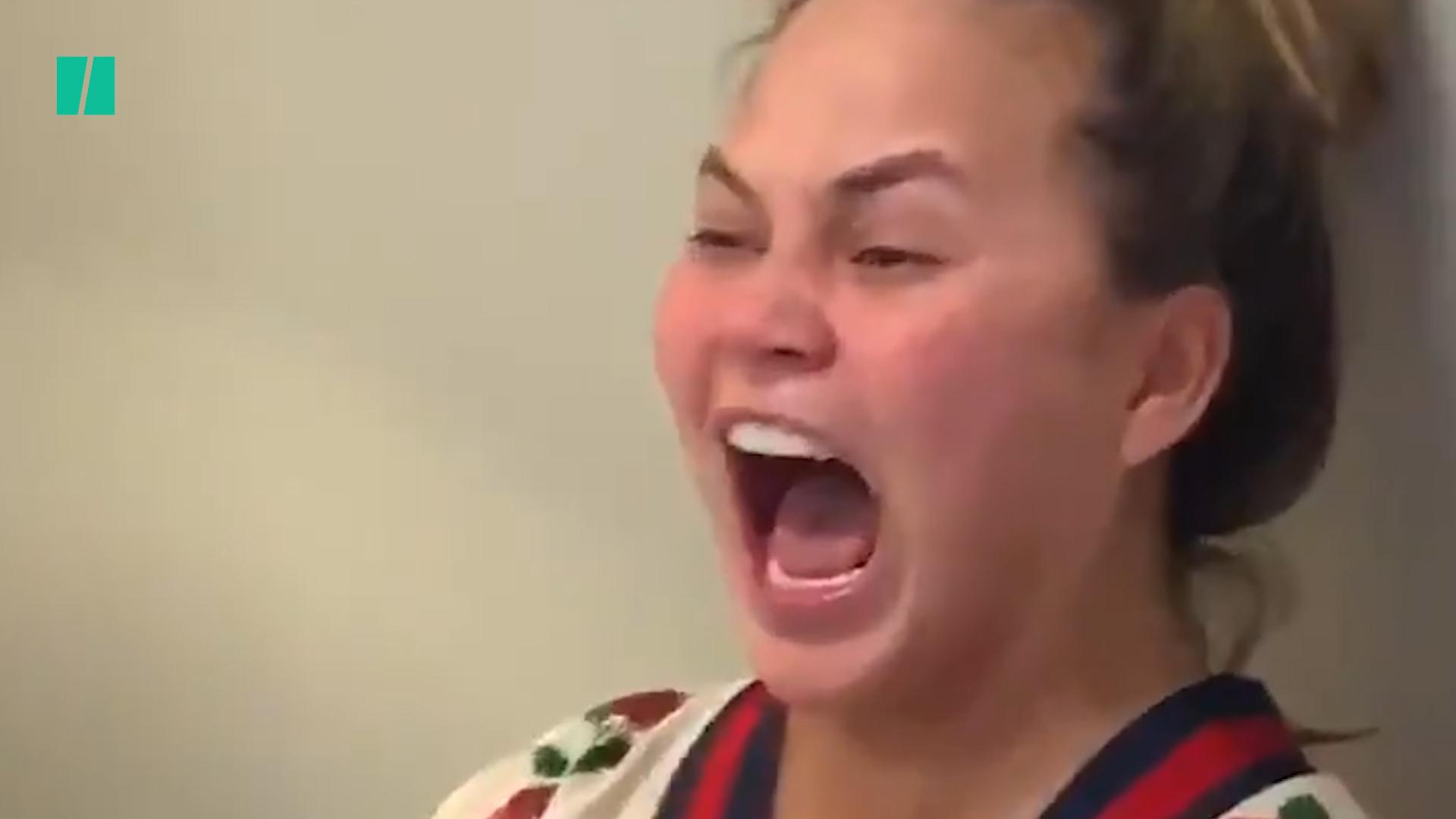 Chrissy Teigen Breaks Silence After Viral Bandaged Face Photos Spark ...